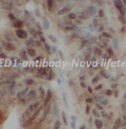 MED1 antibody