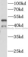 RHD antibody